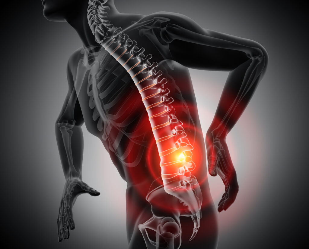 Low Back Injury and Pain After a Car Accident - Presser Law, P.A.