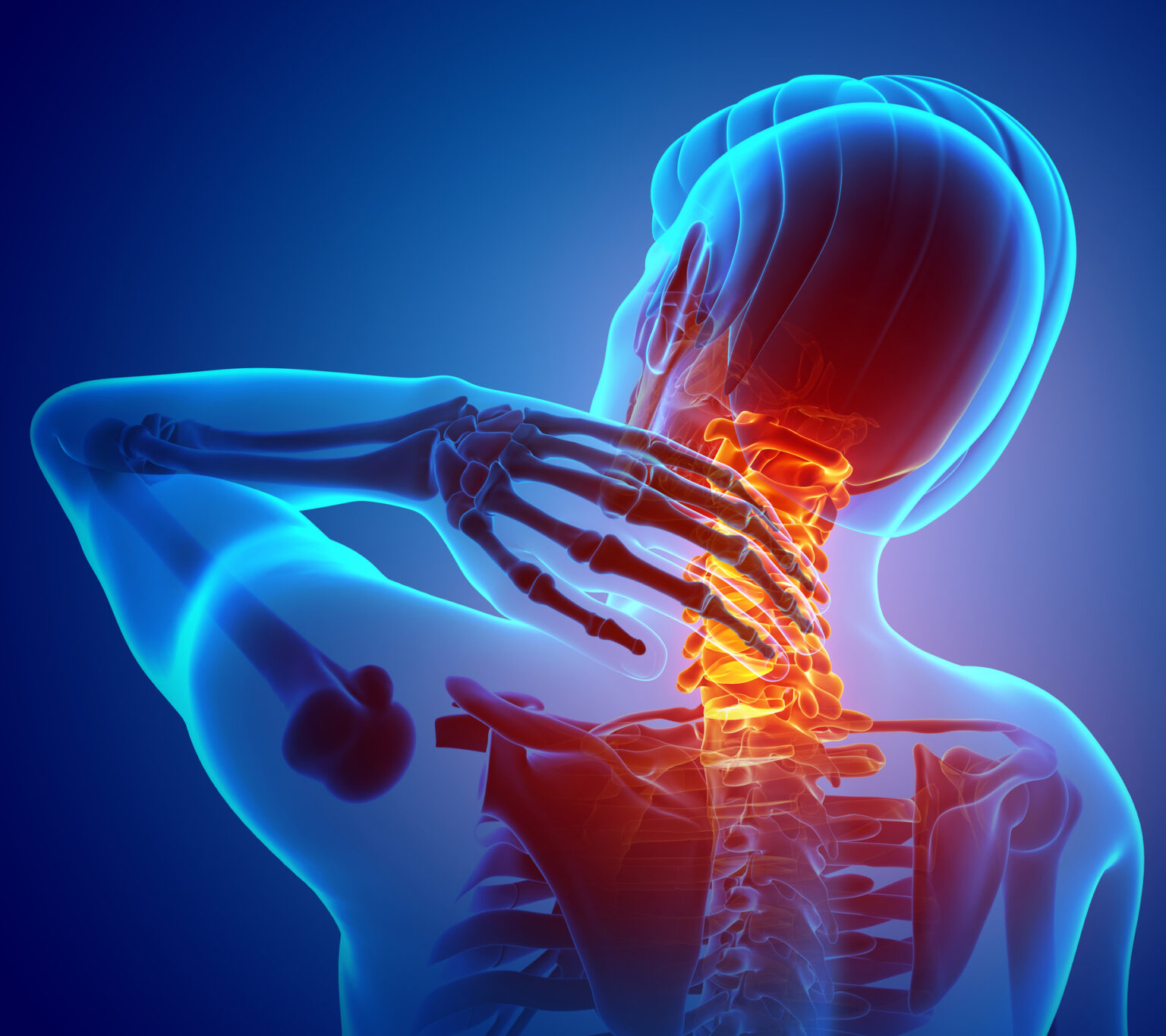 Neck Injury and Pain After a Car Accident - Presser Law, P.A.